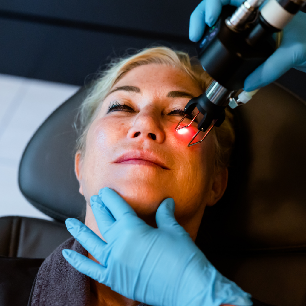 Choose Senara For Tetra Coolpeel Co2 Laser Resurfacing Today